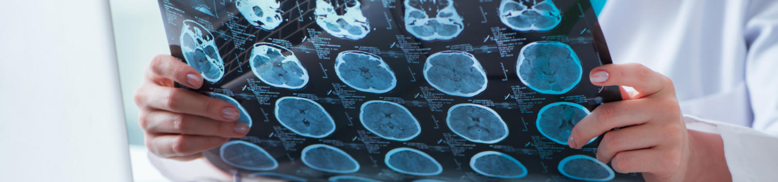 Neuroinflammation 2023: Neurolupus and beyond | Events | Edinburgh ...